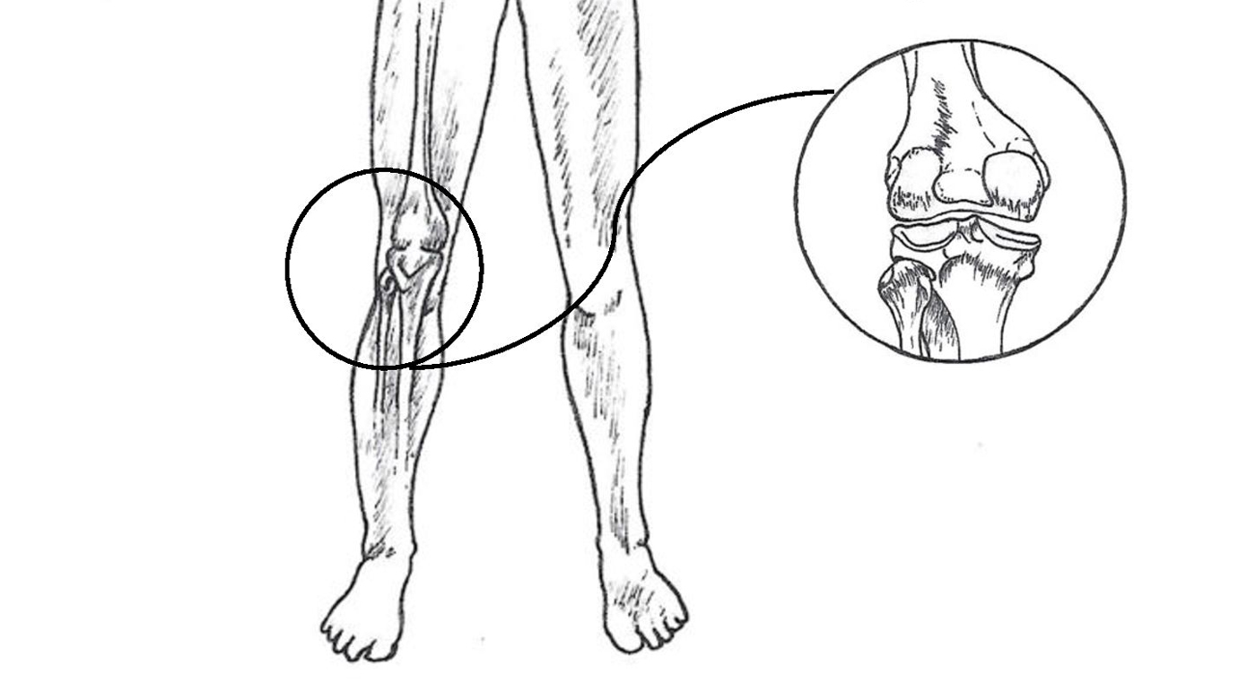Behandling med stamceller i ortopædkirurgien | Ugeskriftet.dk