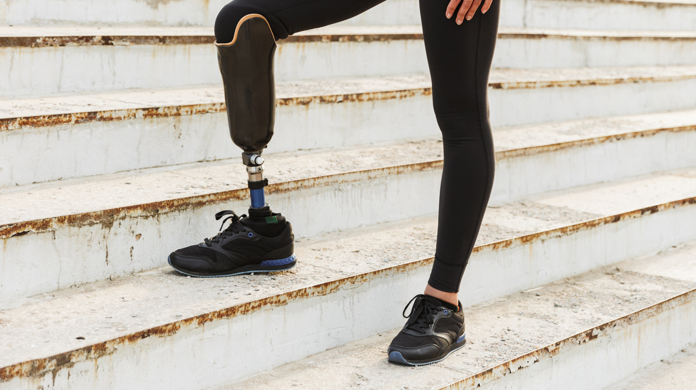 Scheduled surgery during daytime improves outcomes of lower extremity ...