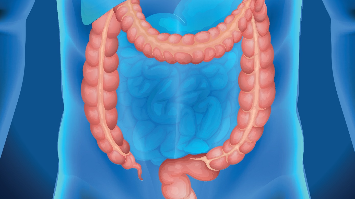 Complications and survival after colorectal cancer surgery associate ...