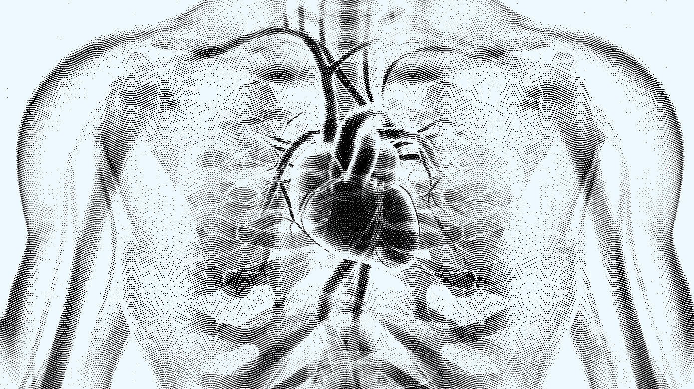 Screening for hjerte-kar-sygdom hos mænd i alderen 60-64 år ...