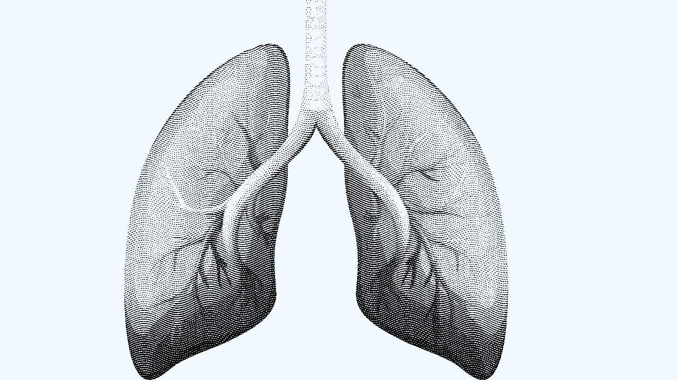 Kateterbaseret behandling til patienter med akut lungeemboli ...