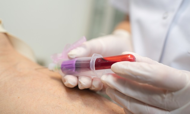 Har AB0-blodtyper betydning for risiko for tromboemboli? | Ugeskriftet.dk