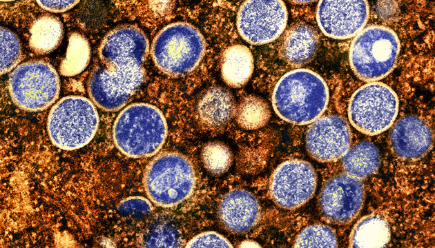 Status på abekopper | Ugeskriftet.dk