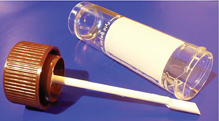 Fækal calprotectin er en klinisk anvendelig markør for intestinal ...