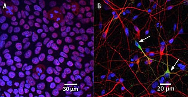 iPS-celler er vejen til forståelsen af neurodegenerative sygdomme ...