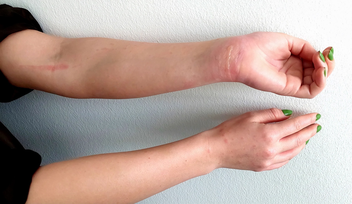 Margaritas in the sun | Ugeskriftet.dk