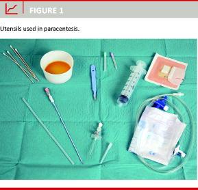 Paracentesis Needle